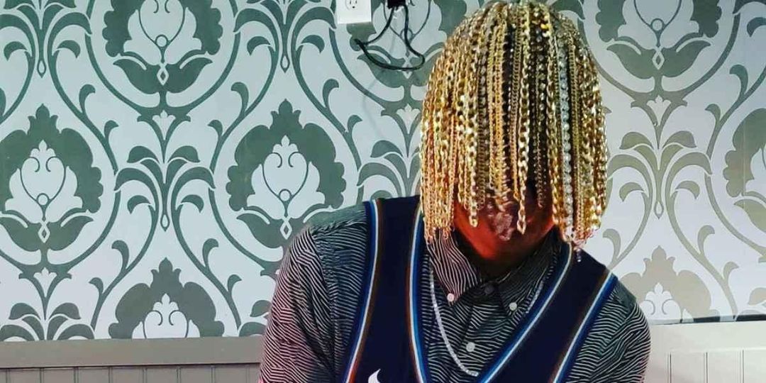 El rapero que se implantó cadenas de oro en su cabeza, - Canal 1